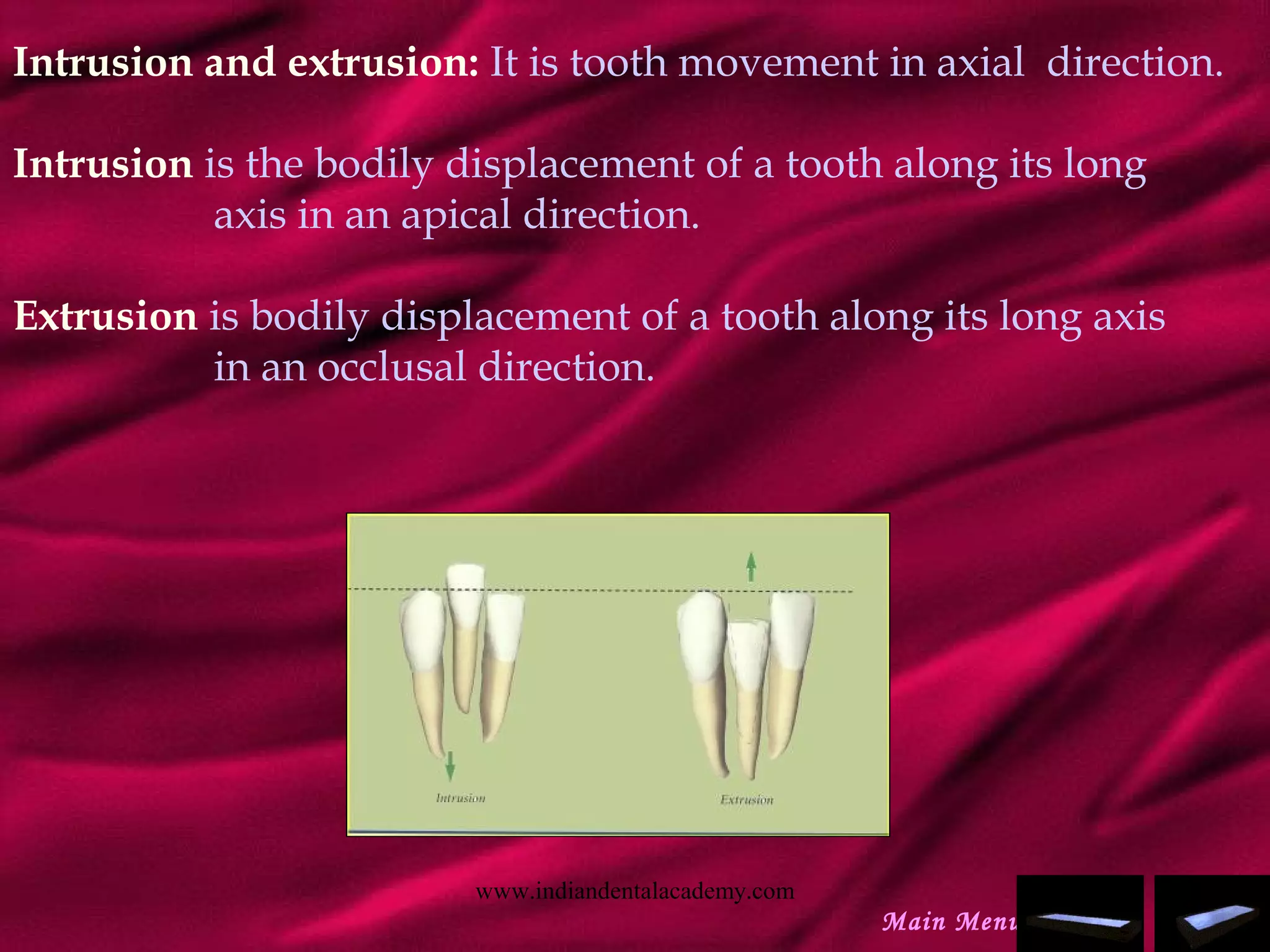 Segmental arch technique | PPT