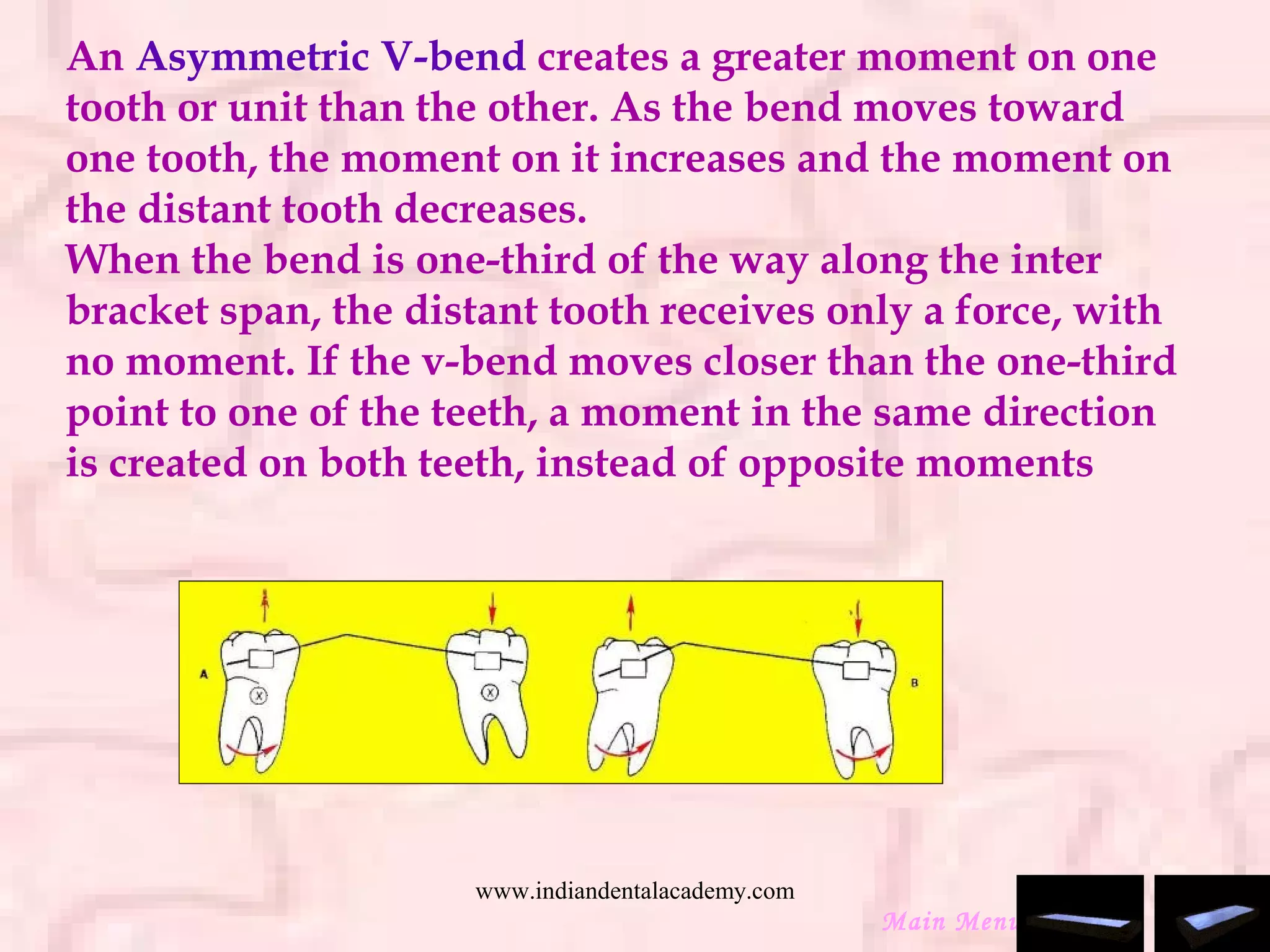Segmental arch technique | PPT