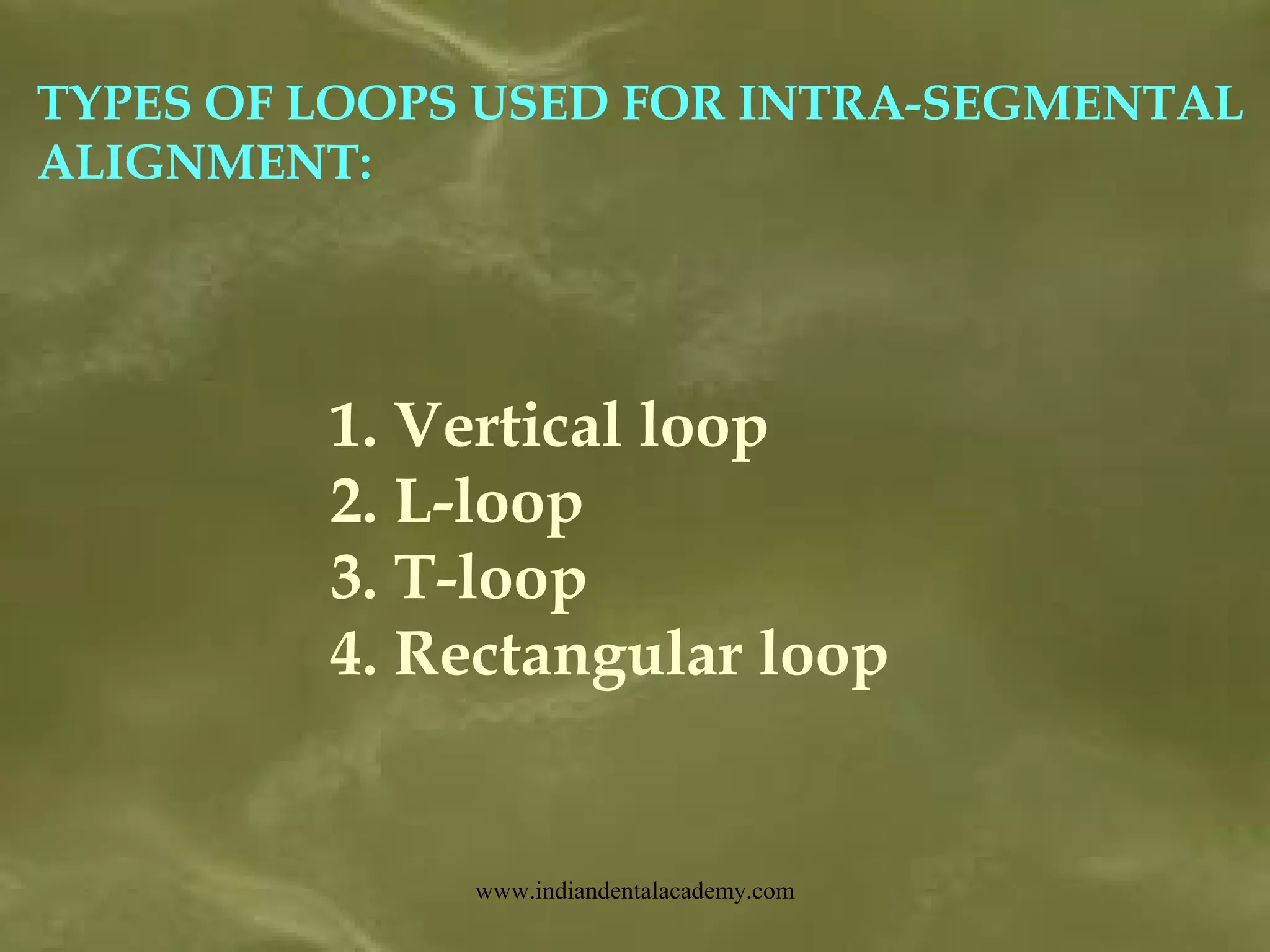 Segmental arch technique | PPT