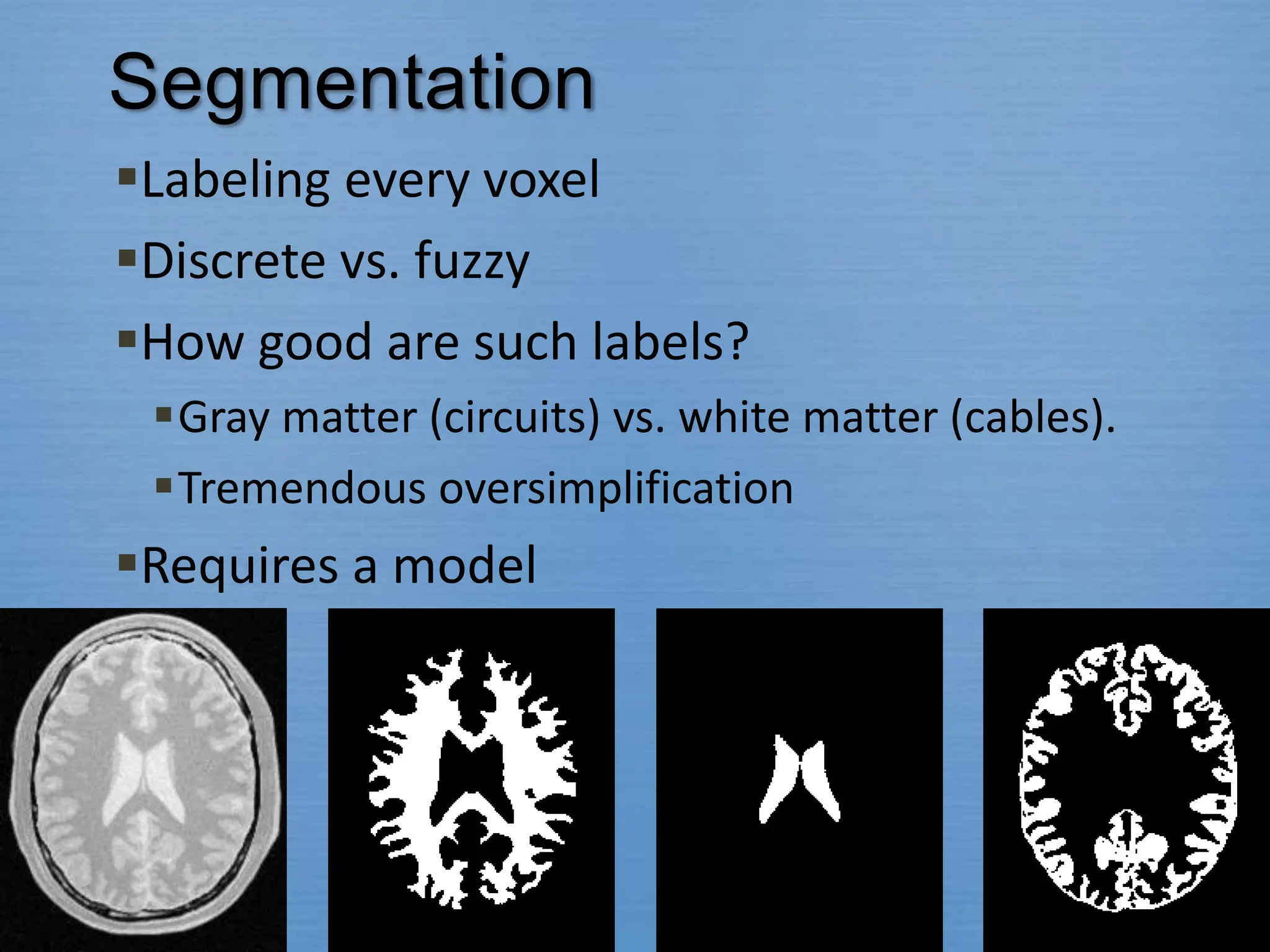 segmentation in image processing methods useful to diagnosis of ...