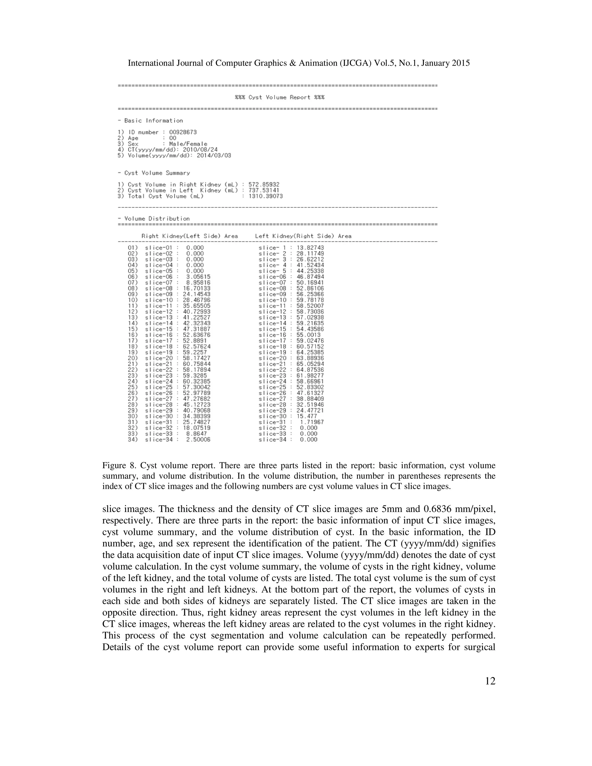 Segmentation of cysts in kidney and 3 d volume calculation from ct ...