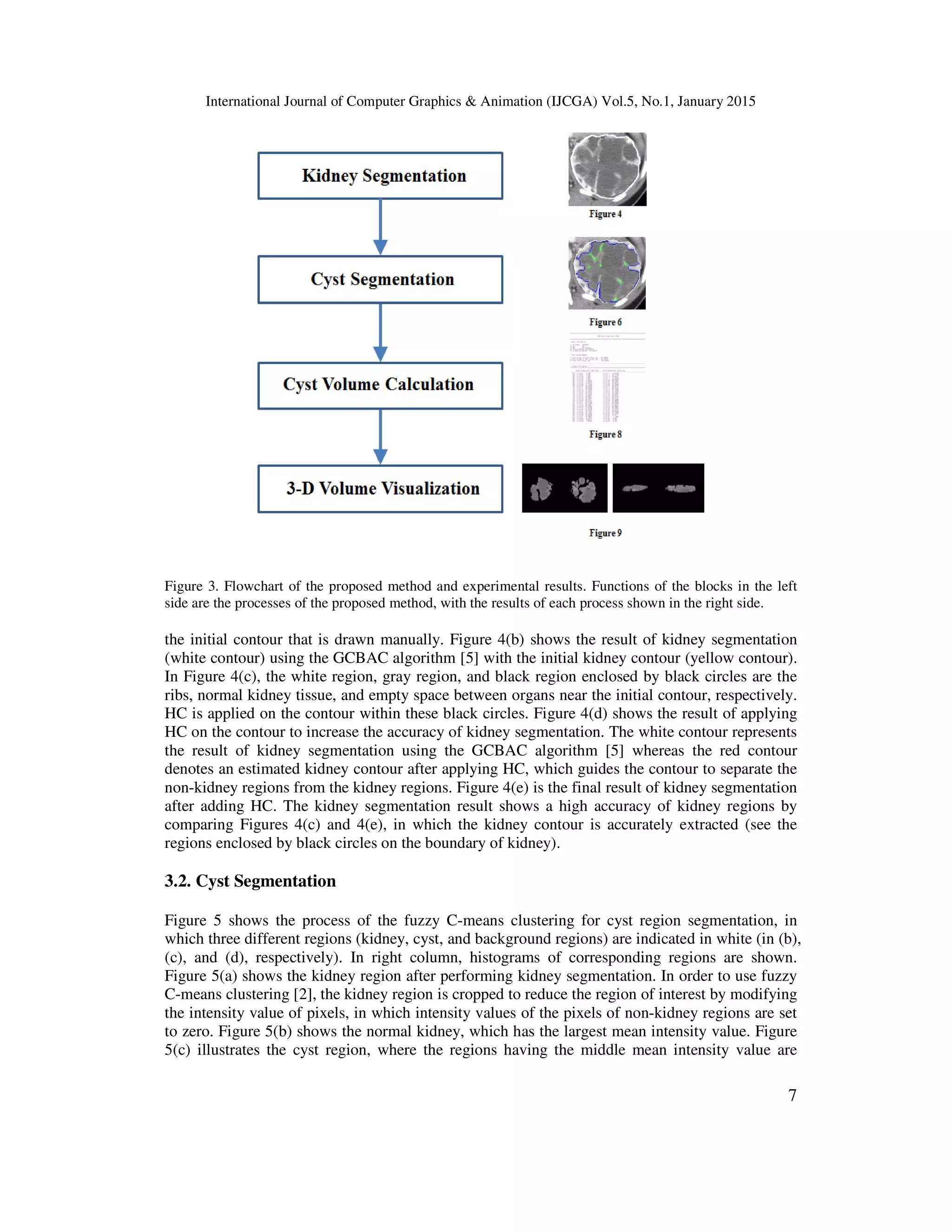 Segmentation of cysts in kidney and 3 d volume calculation from ct ...