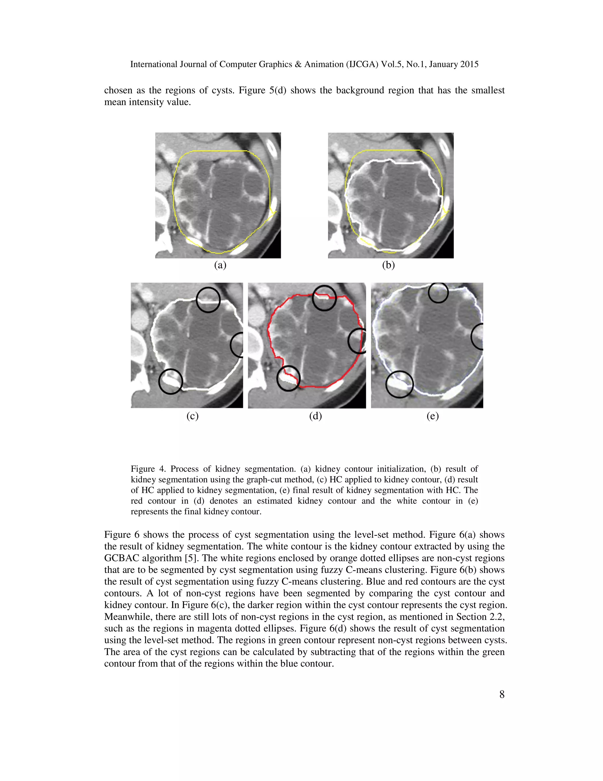 Segmentation of cysts in kidney and 3 d volume calculation from ct ...