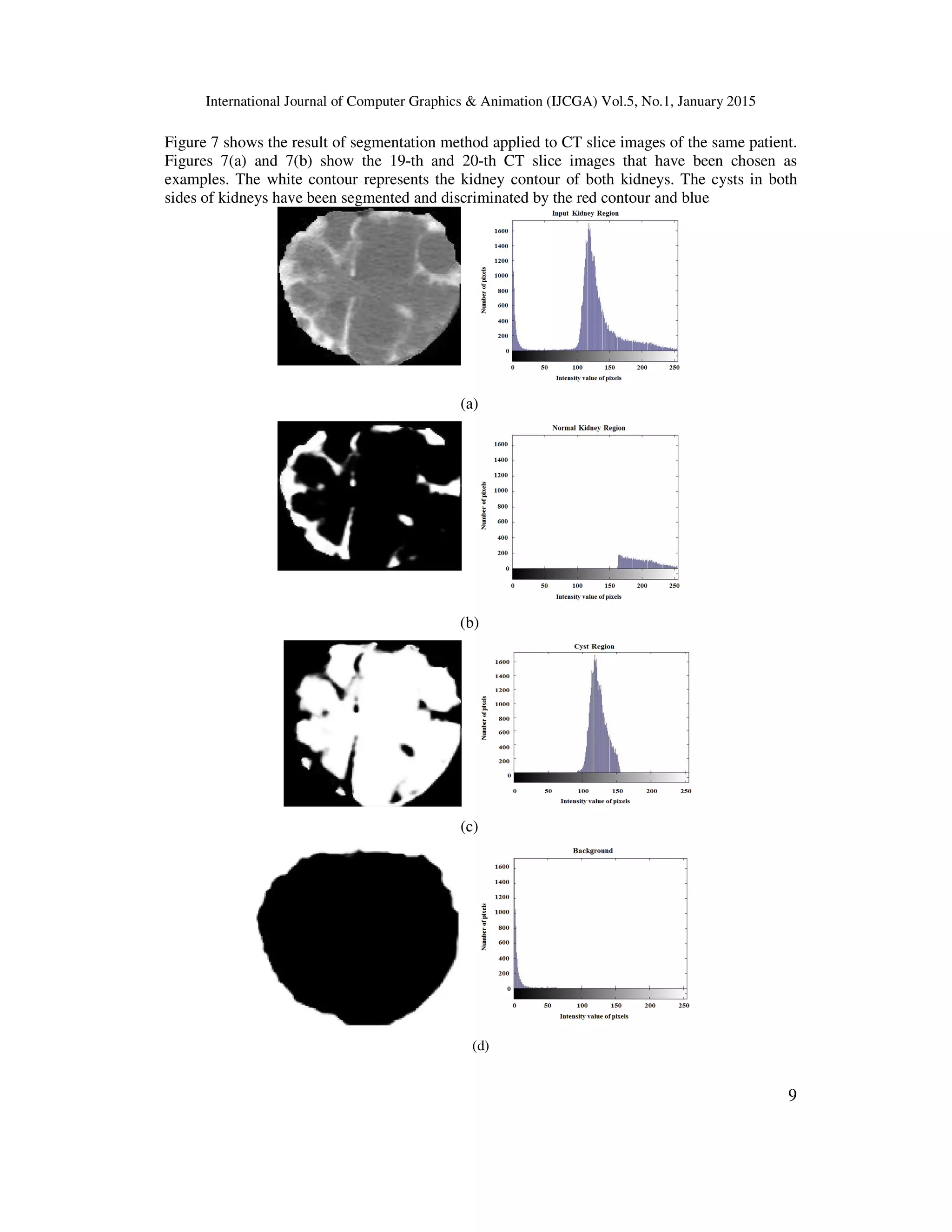 Segmentation of cysts in kidney and 3 d volume calculation from ct ...