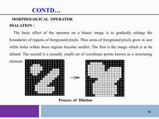 Segmentation techniques for extraction and description of tumour region ...