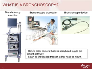 Segmentation of Tracheal Rings in Videobronchoscopy | PPT