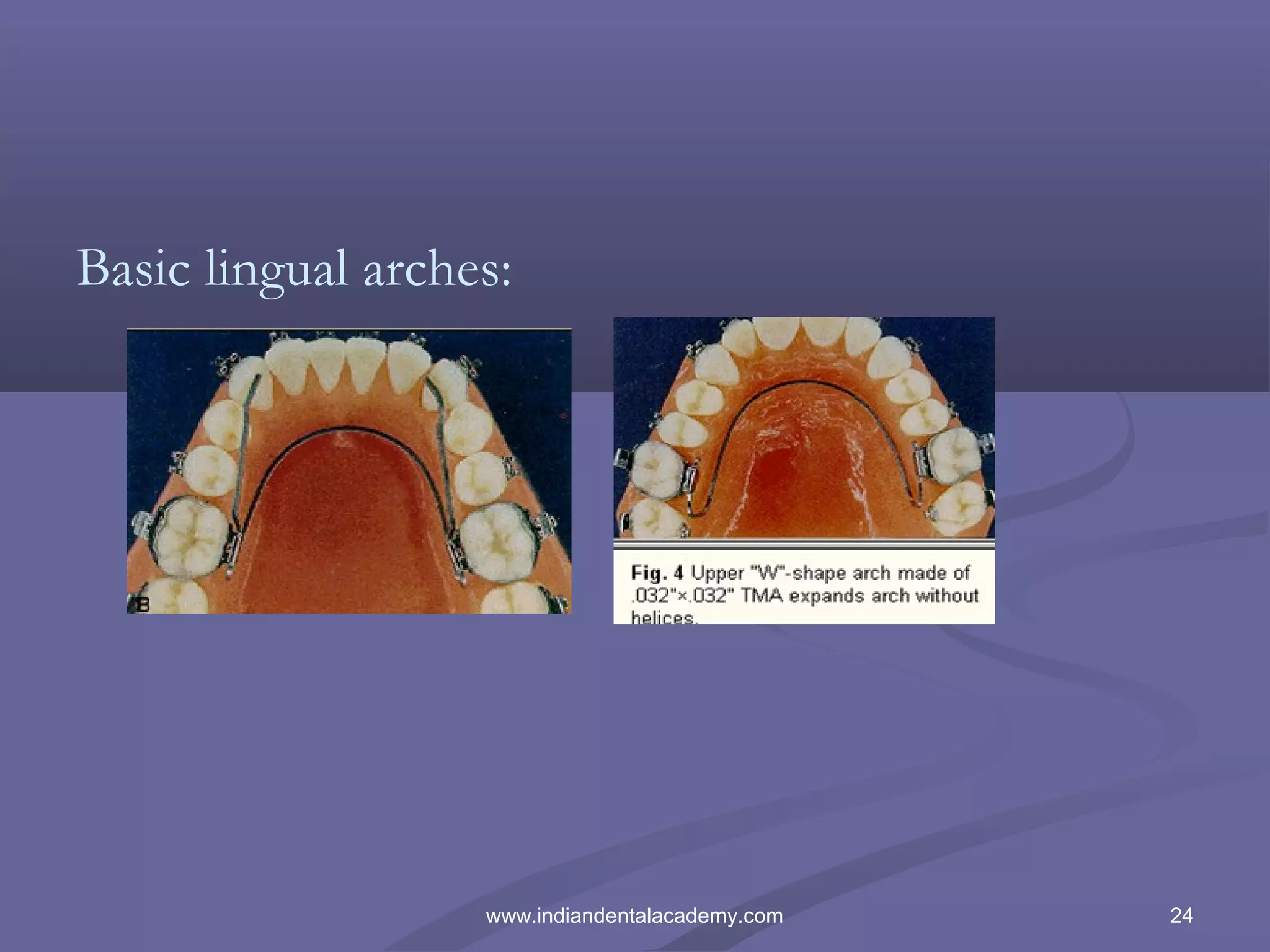 Segmented arch technique /certified fixed orthodontic courses by Indian ...