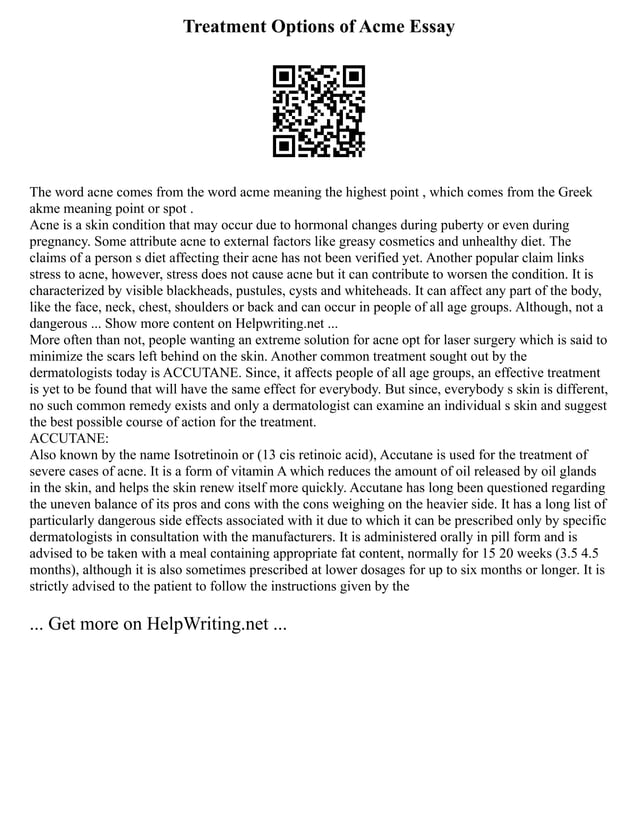 Segmented Essay Nonfiction Writing Tips | PDF