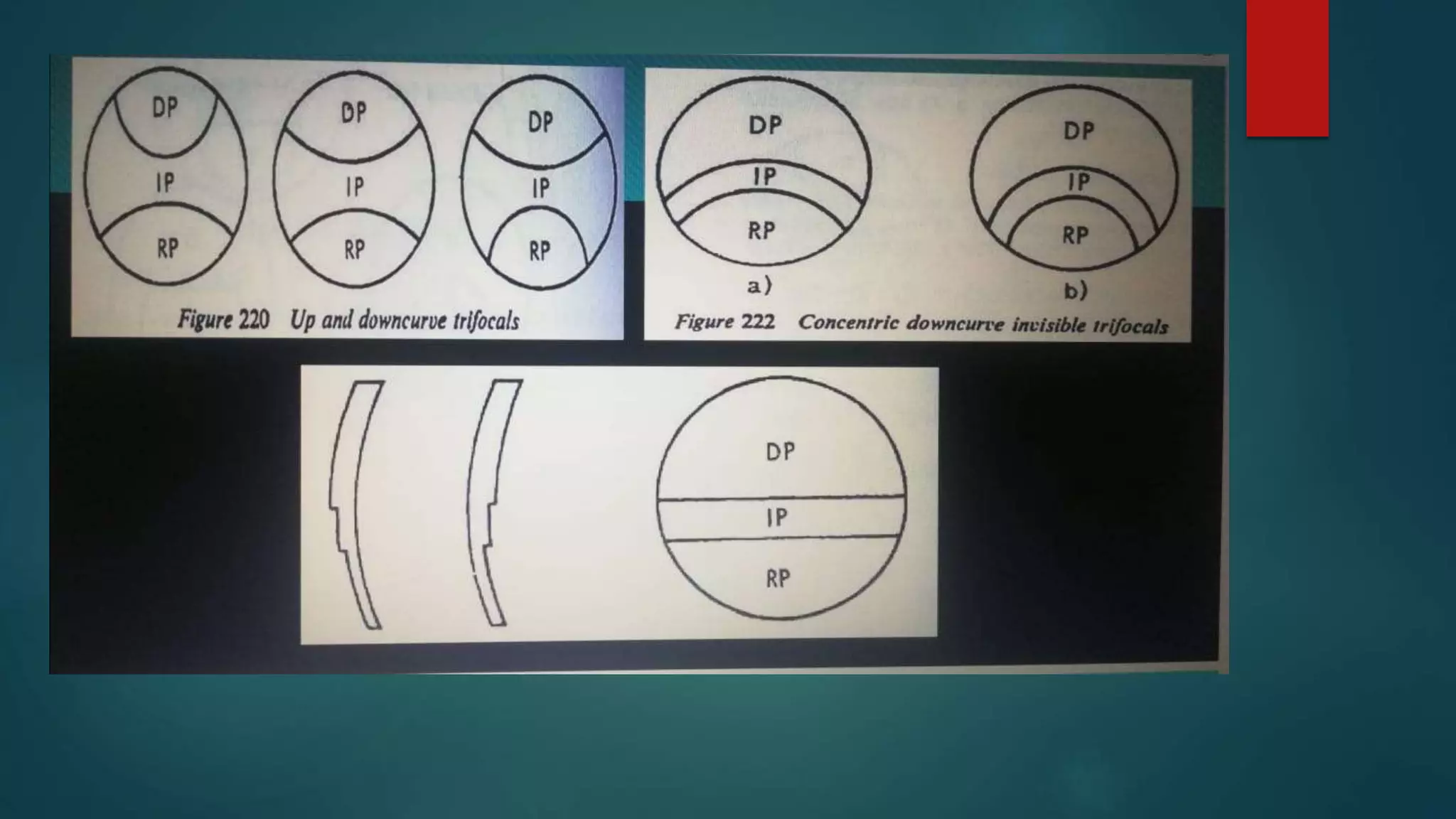 Segmented Multifocal Lenses.pptx