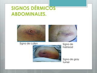 Semiologia segmentos gastrointestinales | PPTX