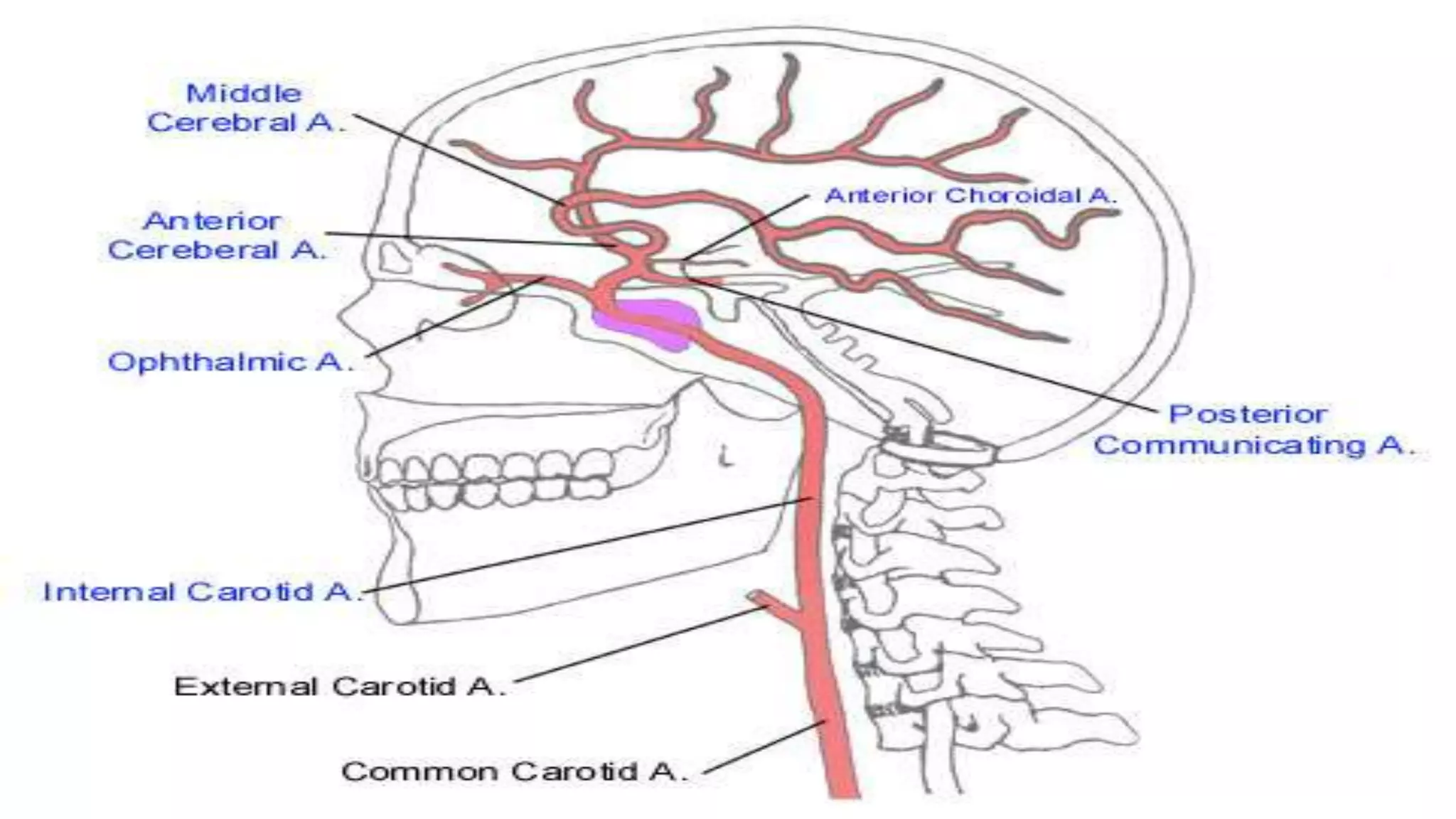 Segments of internal carotid artery | PPTX