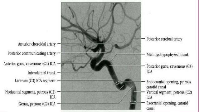 Segments of internal carotid artery