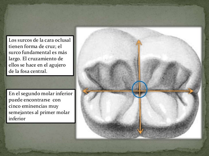 Segunda molar