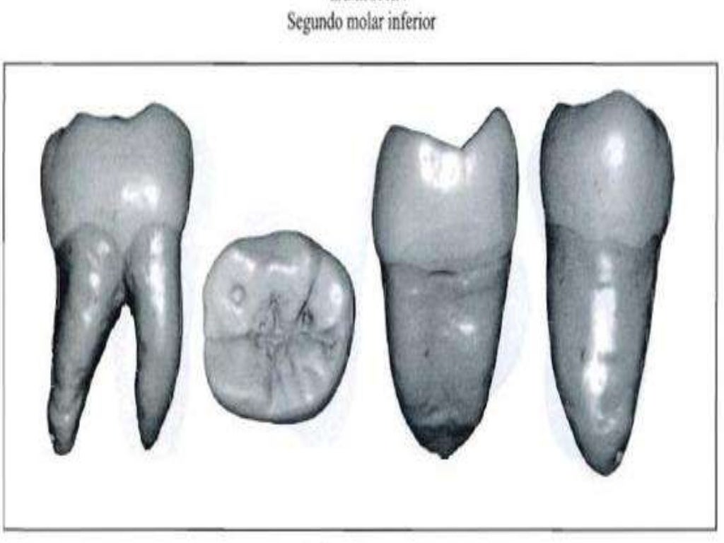 Segundo molar inferior