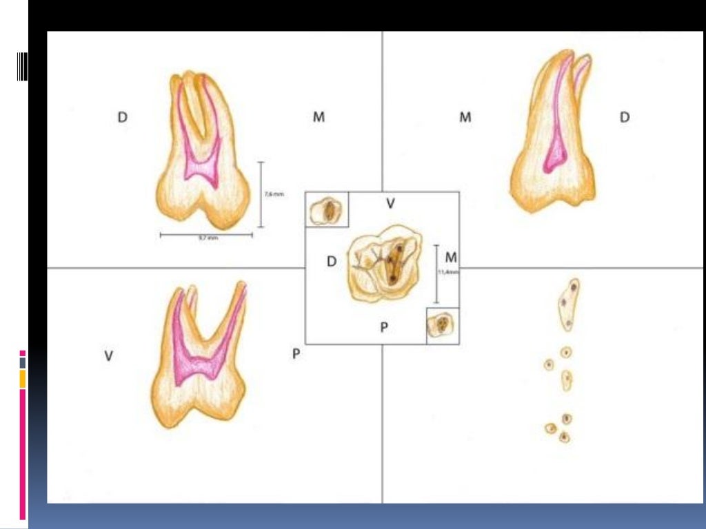 Segundo molar superior