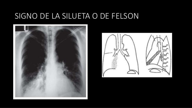 Imagenologia tórax y abdomen