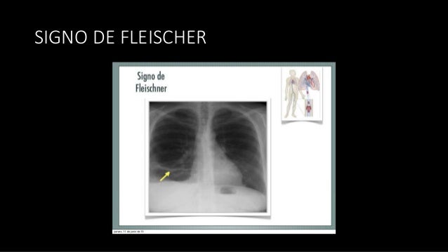 Imagenologia tórax y abdomen