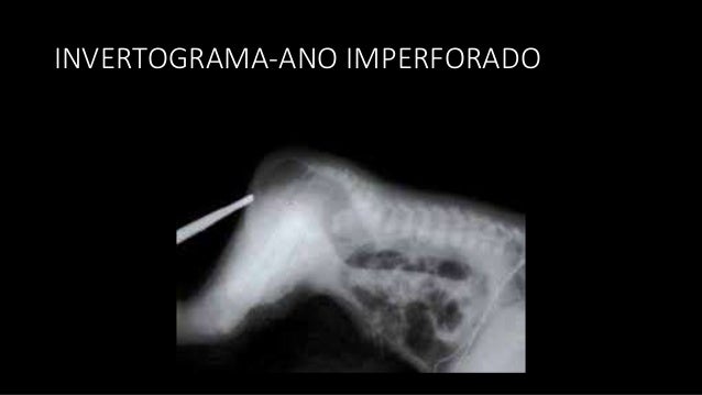 Imagenologia tórax y abdomen
