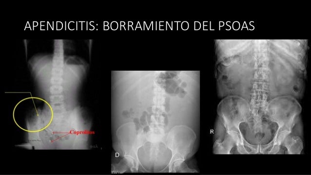 Imagenologia tórax y abdomen