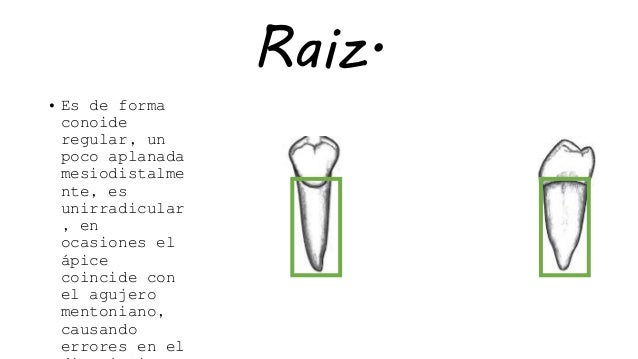 Segundo premolar inferior