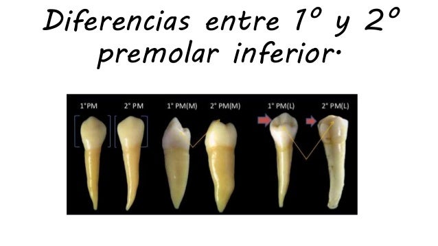 Segundo premolar inferior