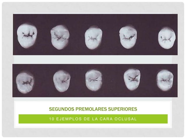Segundo premolar superior | PPTX