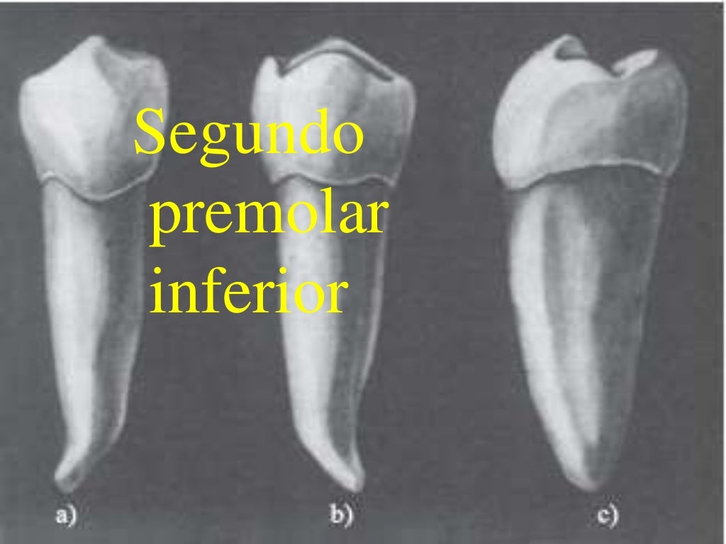 Segundo premolar superior y inferior