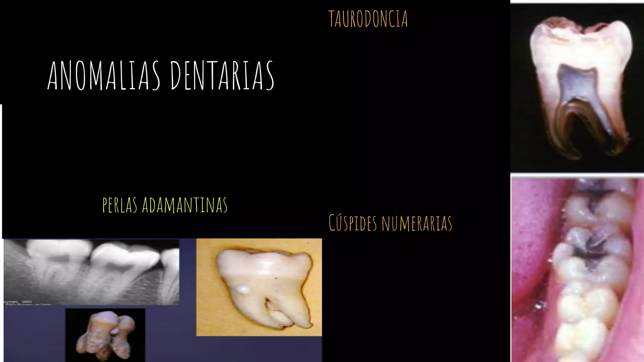 Segundos molares superior e inferior, permanentes. | PDF