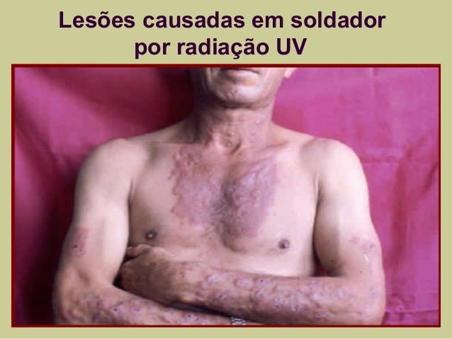 Segurança em Trabalho com Solda