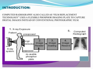 COMPUTED RADIOGRAPHY BY SEHRISH | PPT