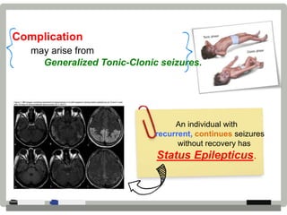 Seizure Disorders | PPTX