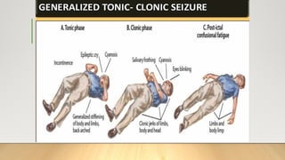 Seizure disorders and its types, pathophysiology | PPTX