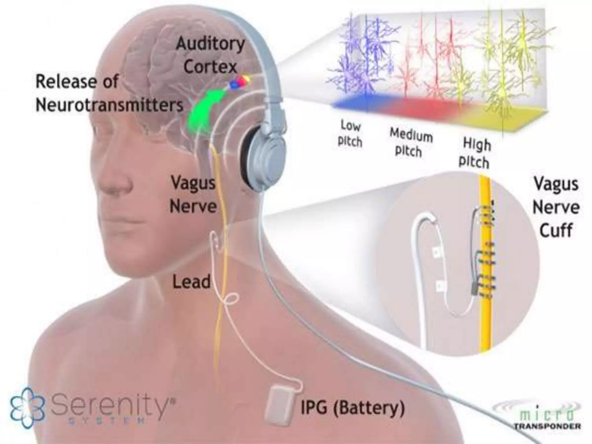 Seizure and epilepsy | PPTX