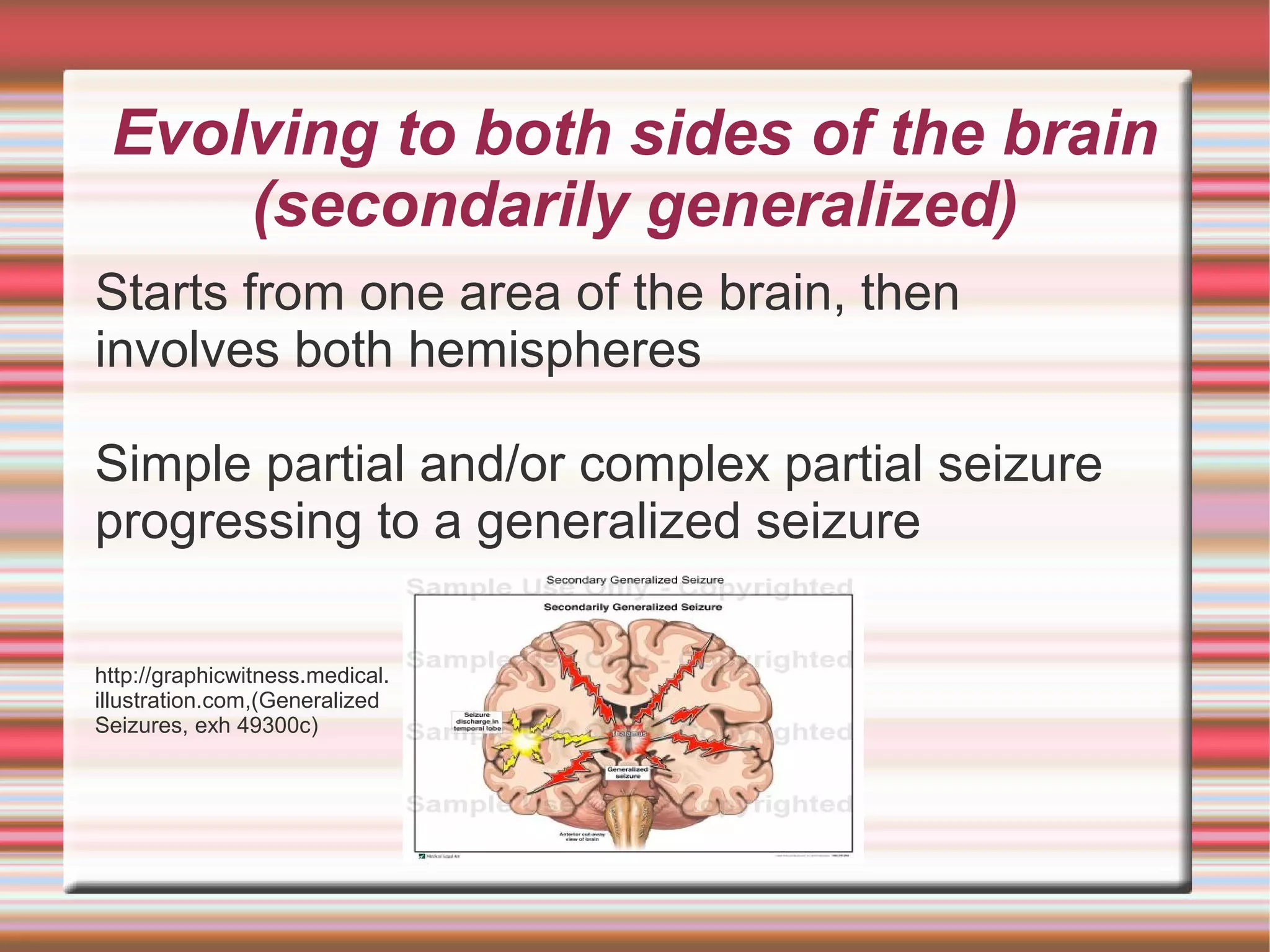 Seizure Classification | PPT