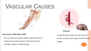 Seizure Group xxxxx.pptx