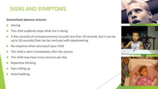 Seizure in children | PPTX