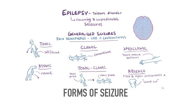 Seizure localization; based on semiology
