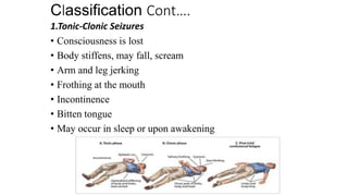 Introduction to seizure and epilepsy ppt | PPTX | Brain and Nervous ...