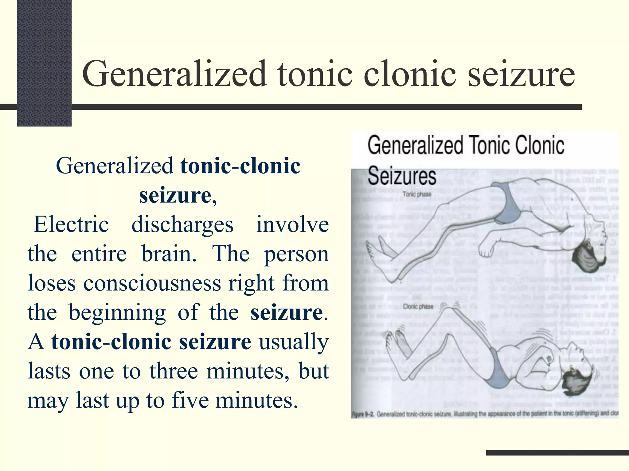 Seizures | PPTX