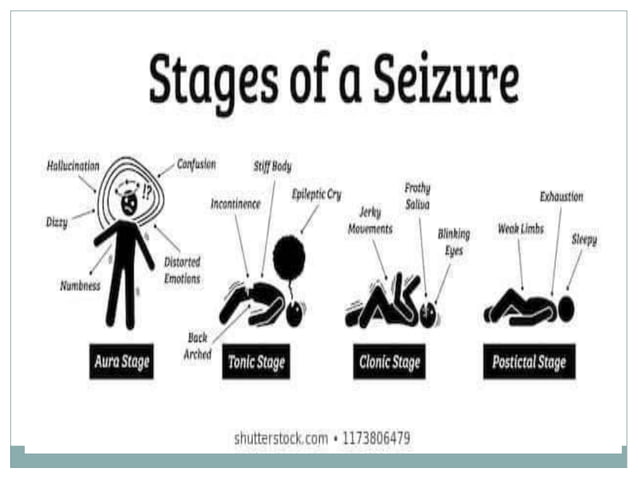 Seizures | PPT