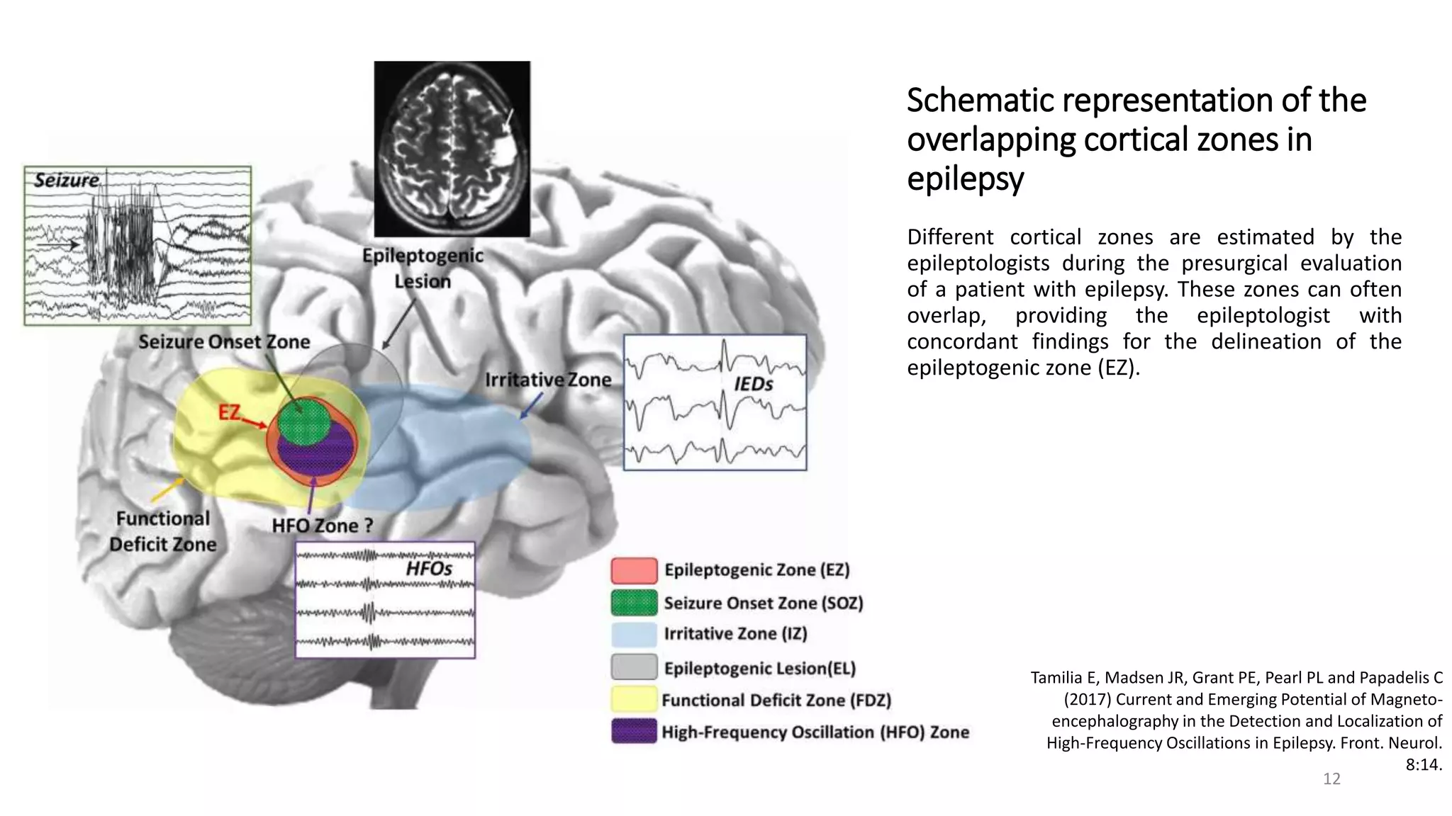 Seizure Semiology: Introduction | PPTX