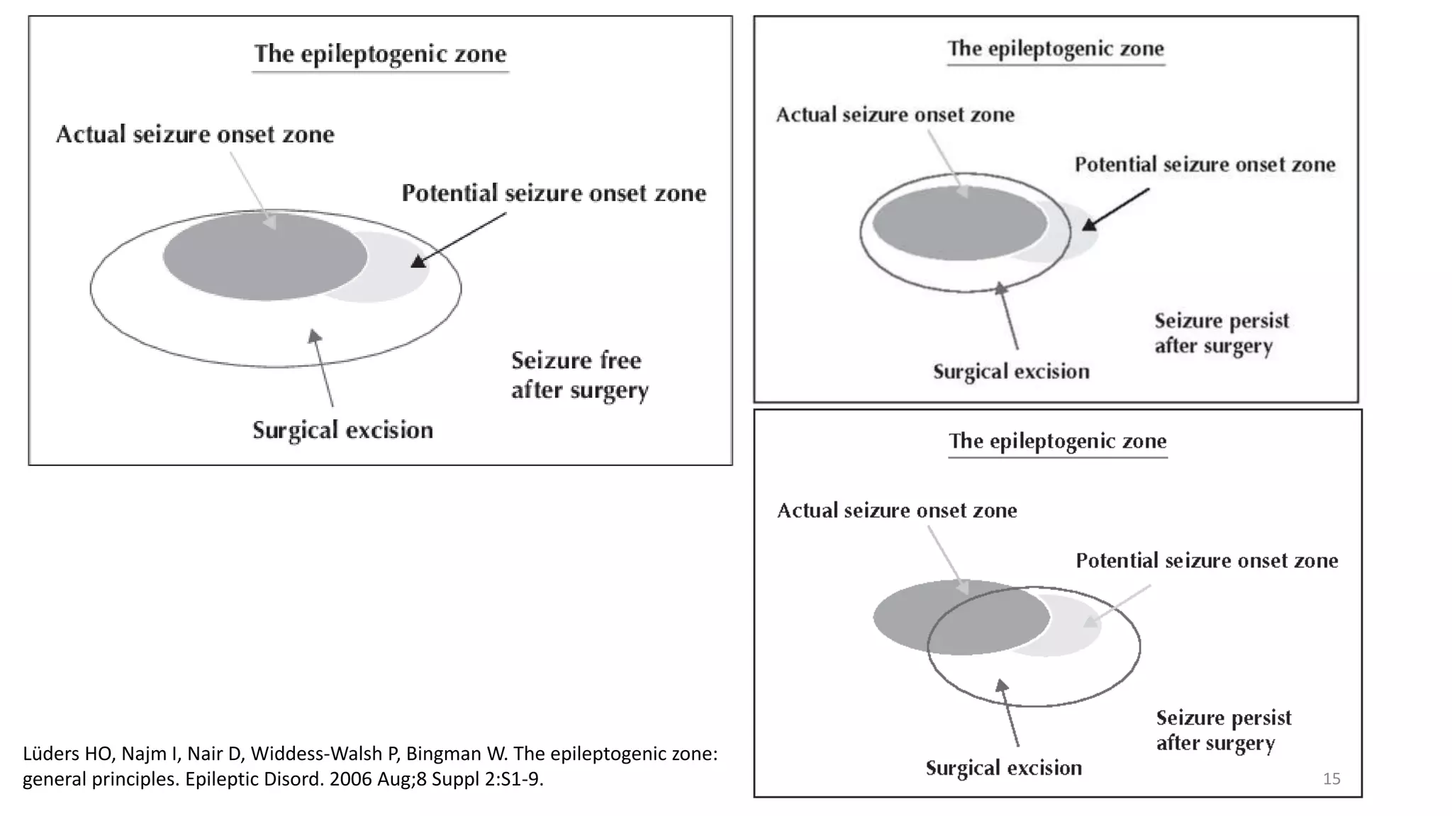 Seizure Semiology: Introduction | PPTX