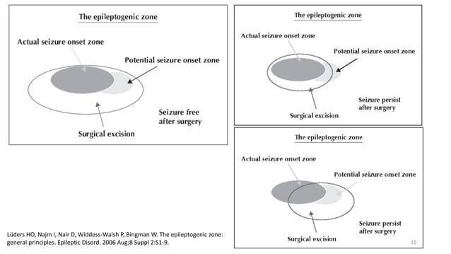 Seizure Semiology: Introduction | PPTX