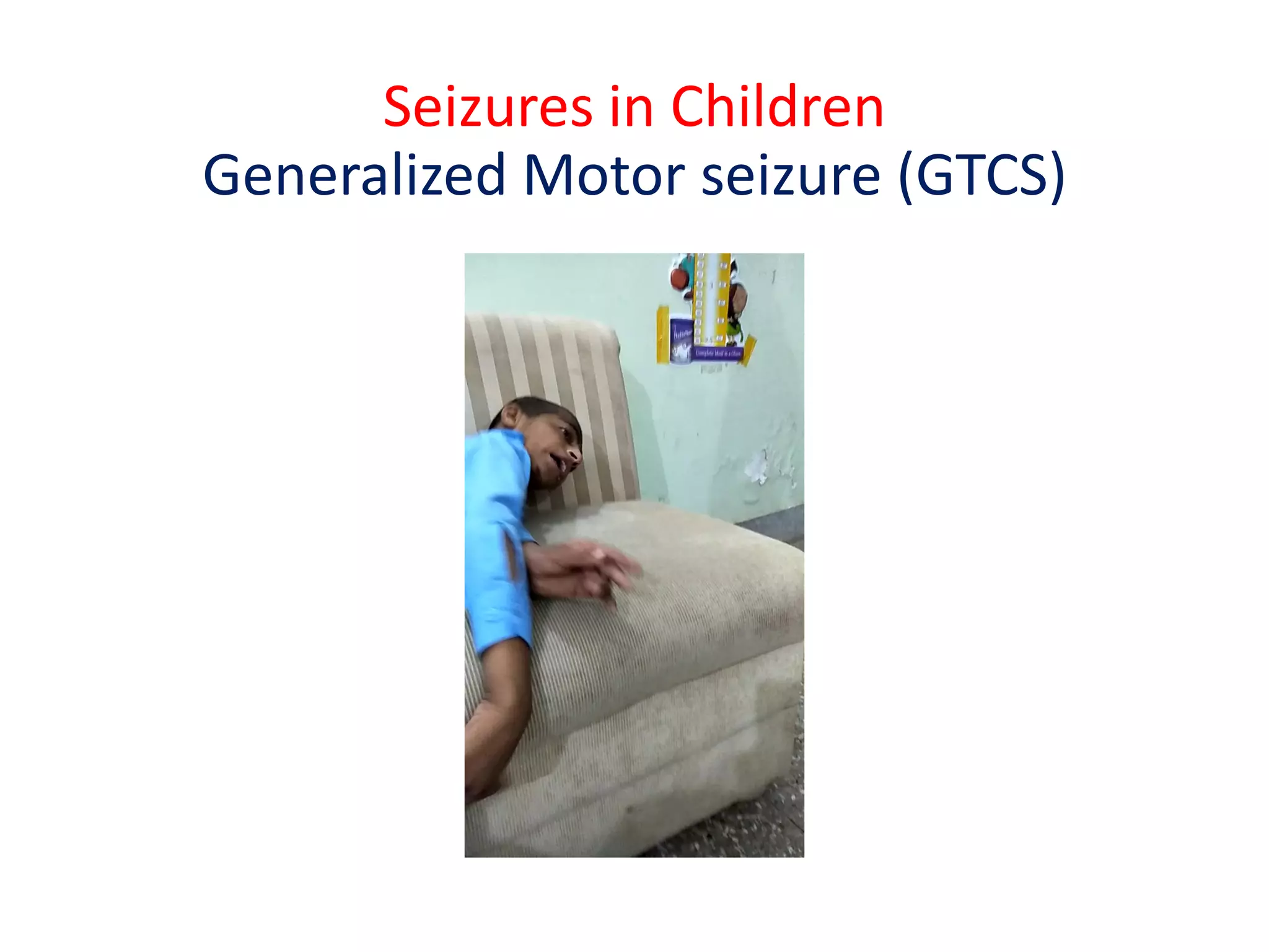 Seizures in children 2021 | PDF