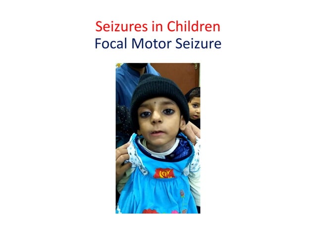 Seizures in children 2021 | PDF | Brain and Nervous System Disorders ...