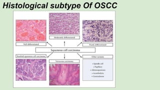 (Oral Squamous Cel Carcinoma).pptx