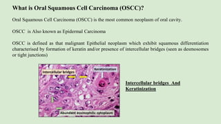 (Oral Squamous Cel Carcinoma).pptx