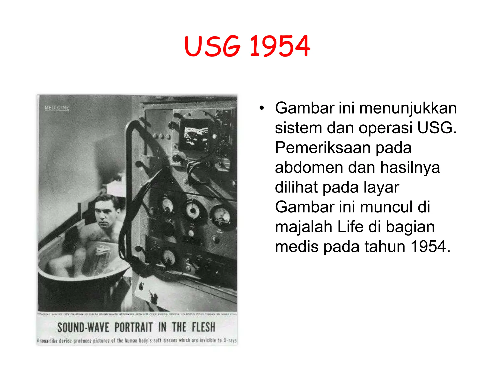 Sejarah dan Perkembangan USG (1).pptx