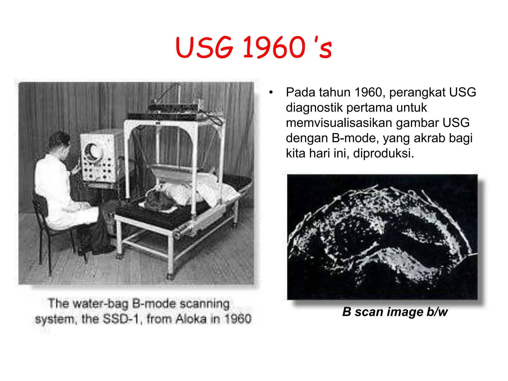 Sejarah dan Perkembangan USG (1).pptx