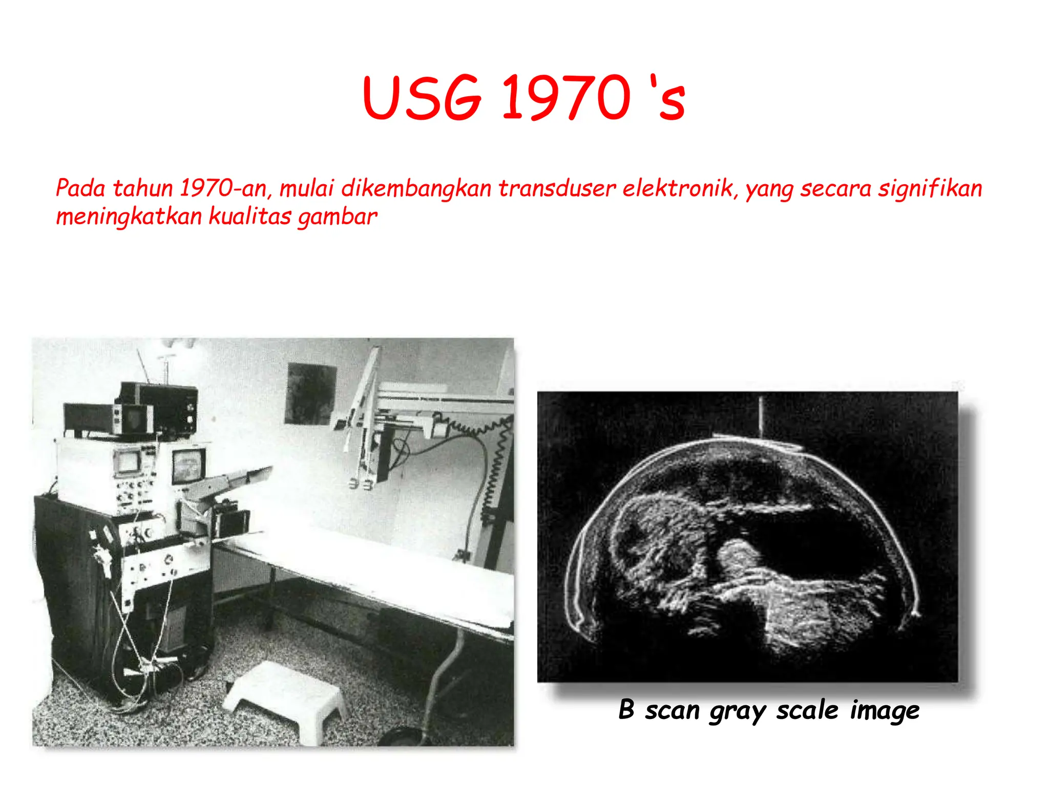 Sejarah dan Perkembangan USG (1).pptx